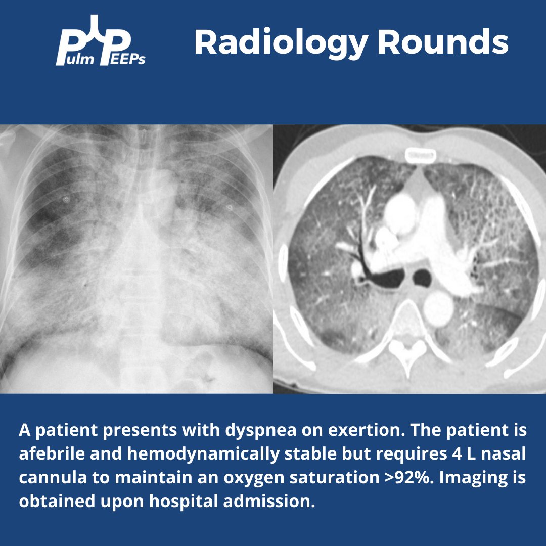 Radiology Rounds – 1/11/22 | PulmPEEPs