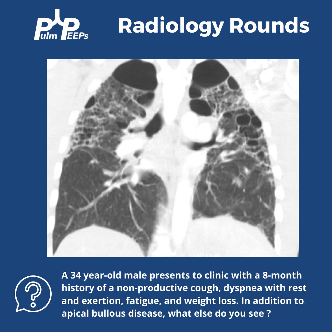 Radiology Rounds – 4/5/22 | PulmPEEPs