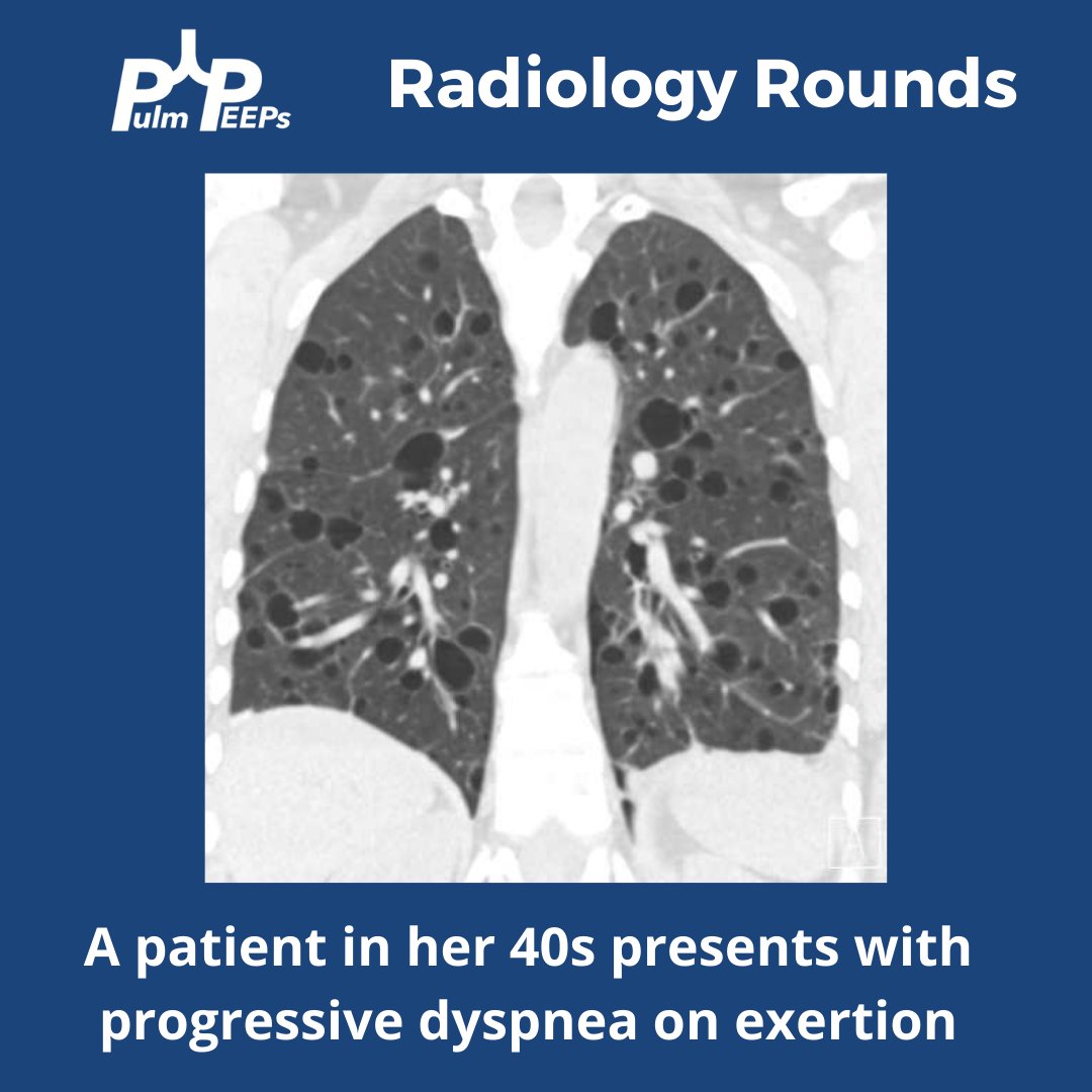 Radiology Rounds – 7/12/22 | PulmPEEPs