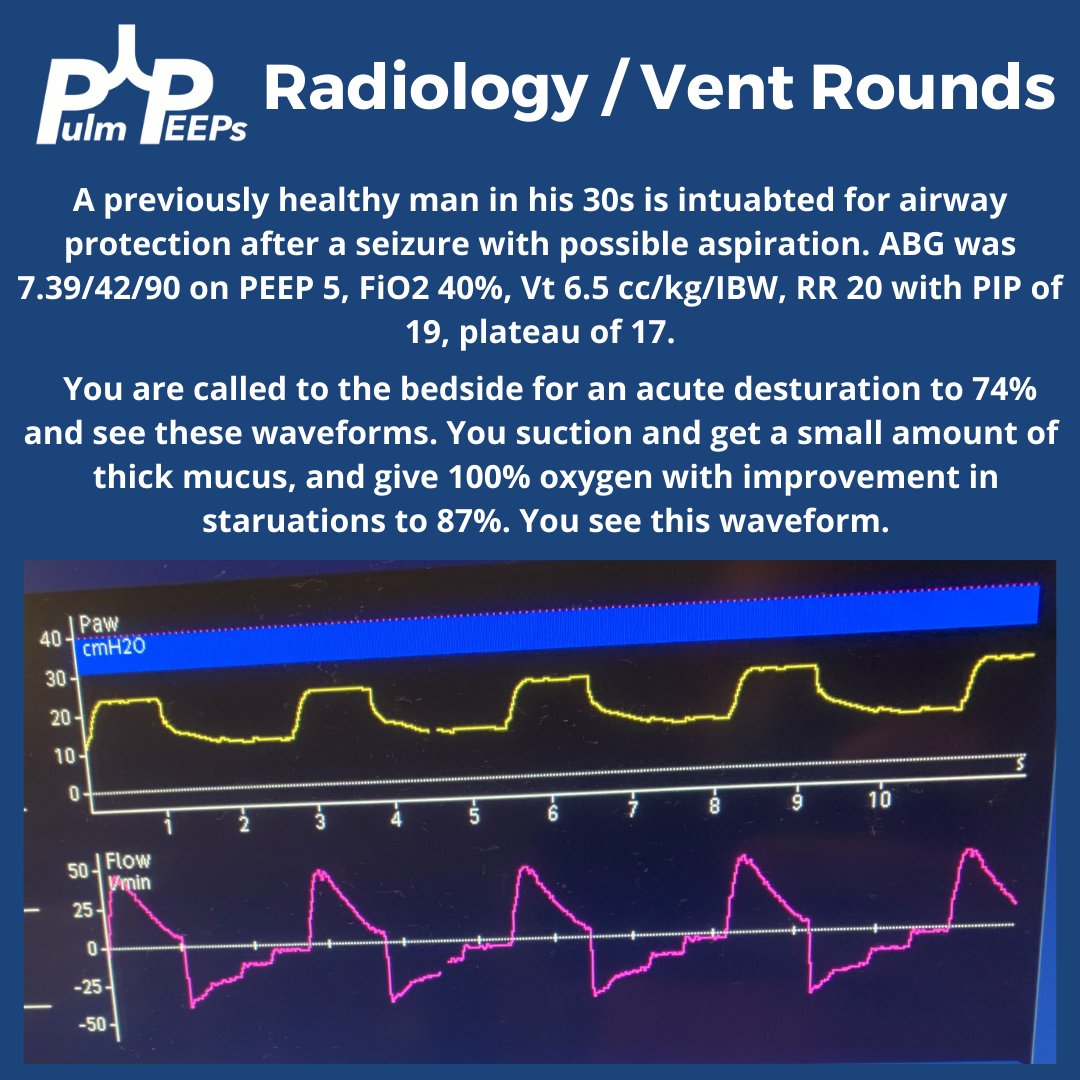 PulmPEEPs | Pulmonary and Critical Care content for learners and ...