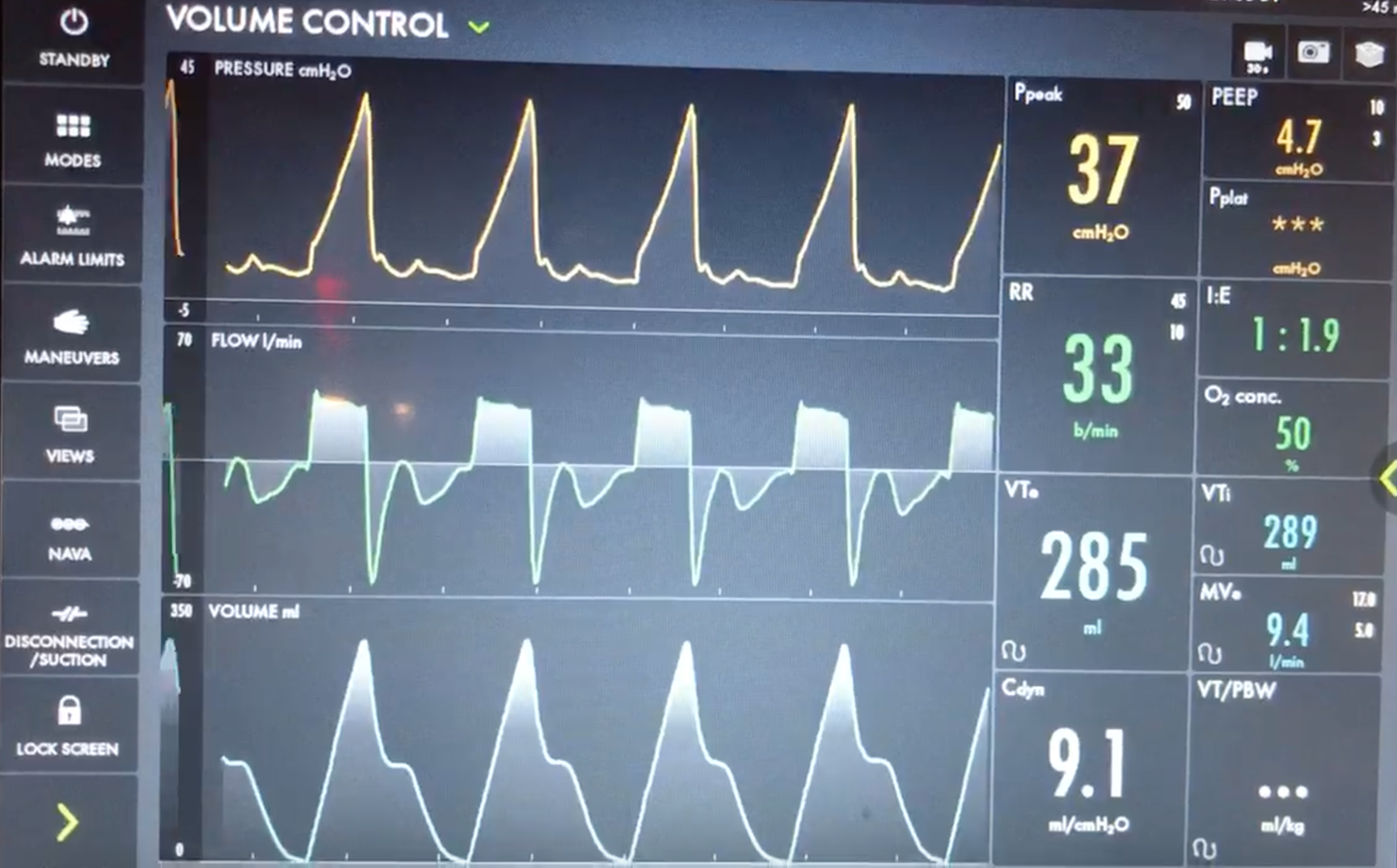 PulmPEEPs | Pulmonary and Critical Care content for learners and practitioners of all levels ...