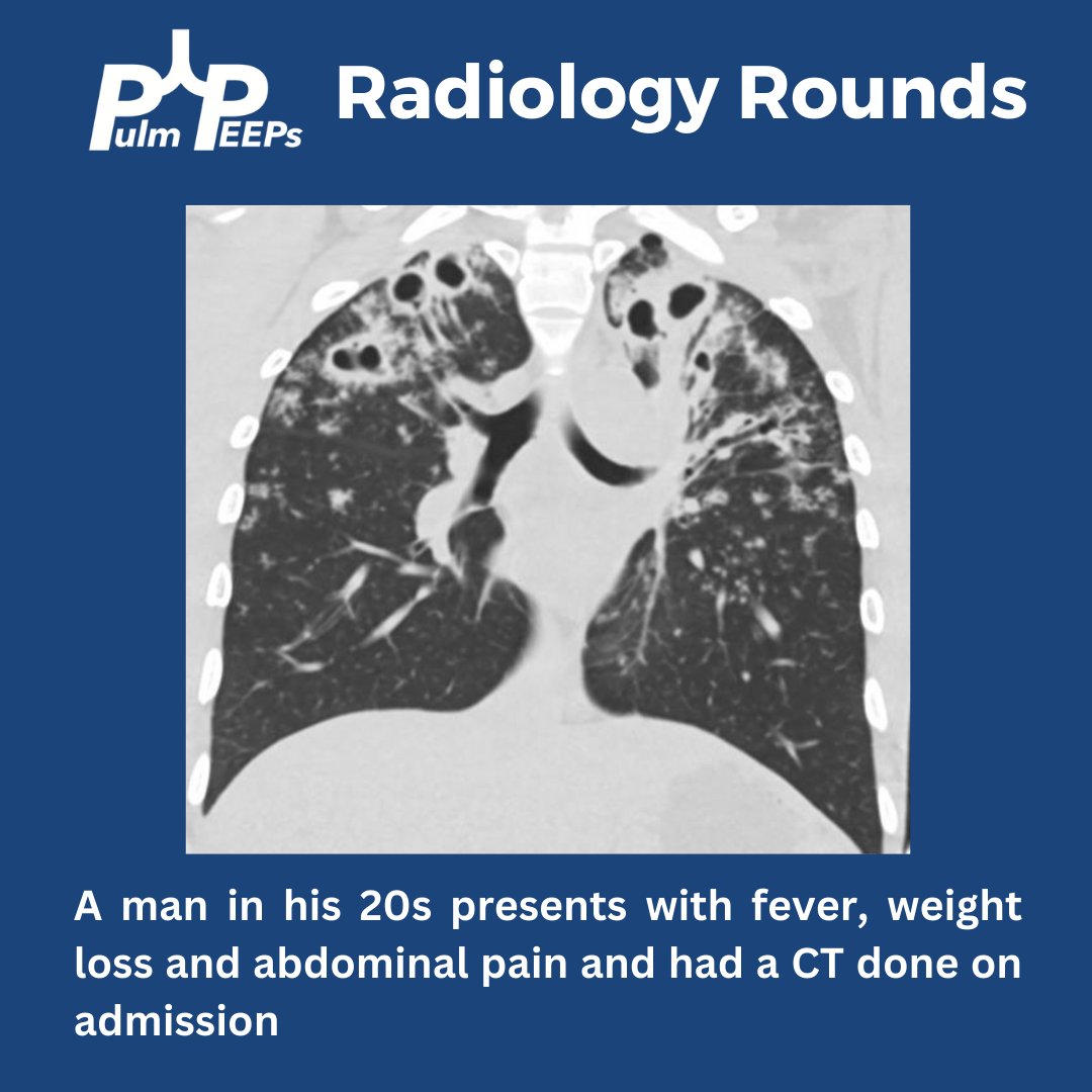 Radiology Rounds – 7/19/23 | PulmPEEPs