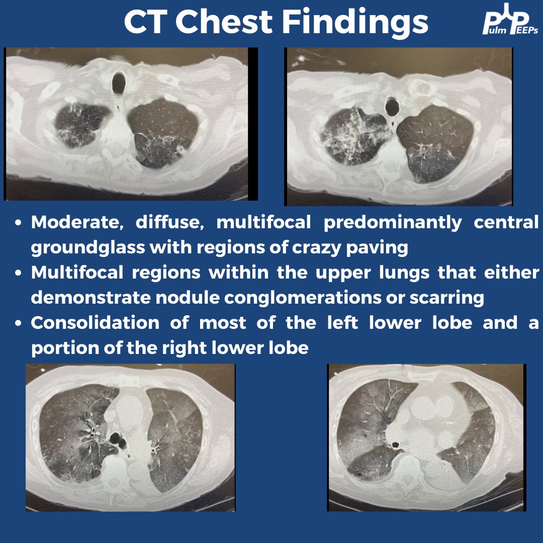 PulmPEEPs | Pulmonary and Critical Care content for learners and practitioners of all levels