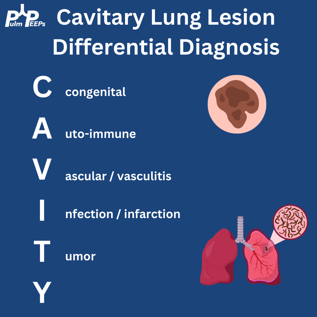 Lung nodule | PulmPEEPs