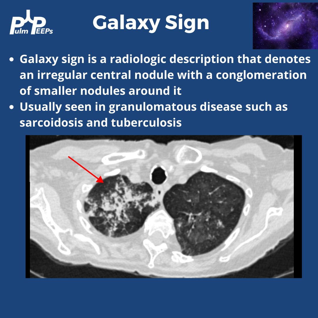 PulmPEEPs | Pulmonary and Critical Care content for learners and ...