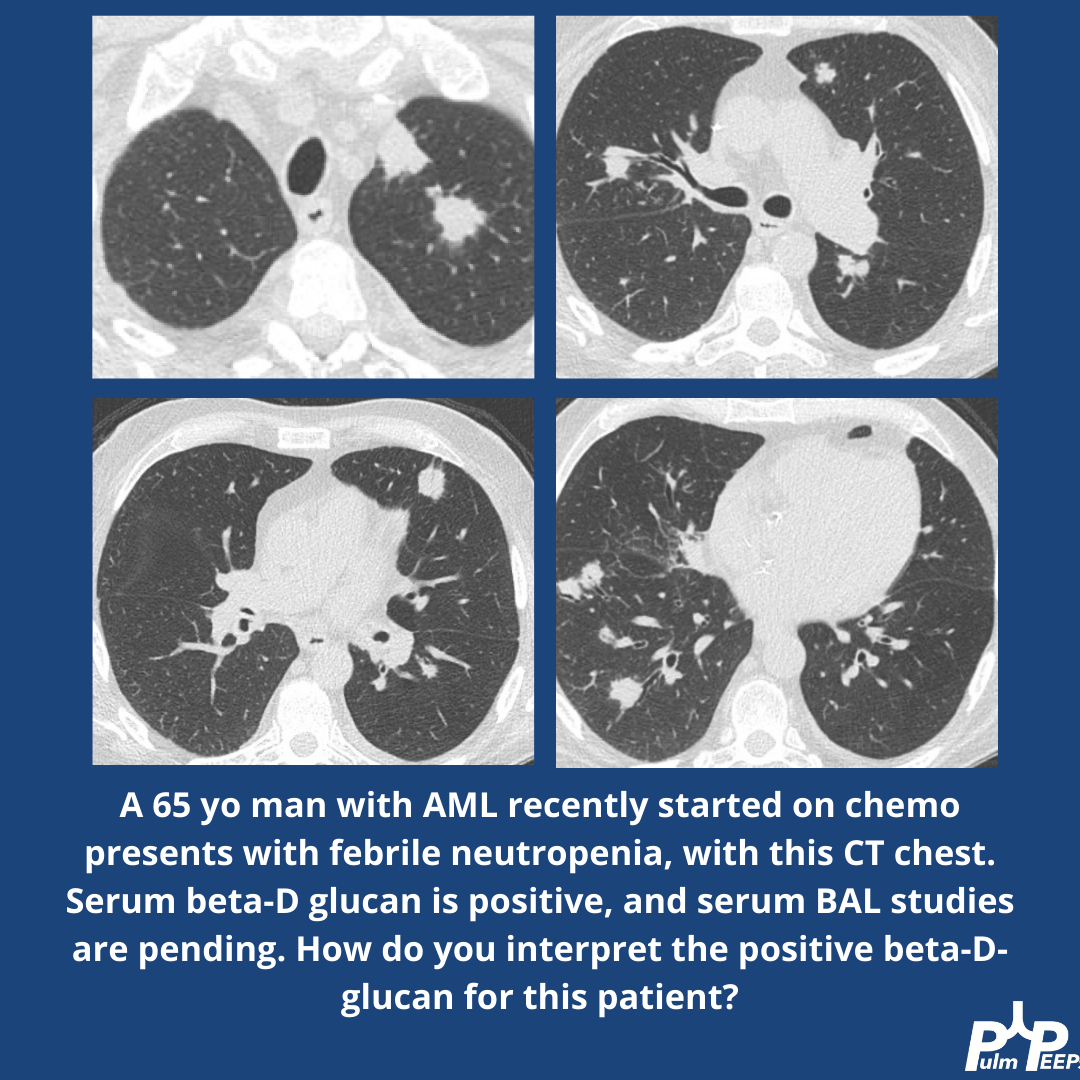 PulmPEEPs | Pulmonary and Critical Care content for learners and practitioners of all levels