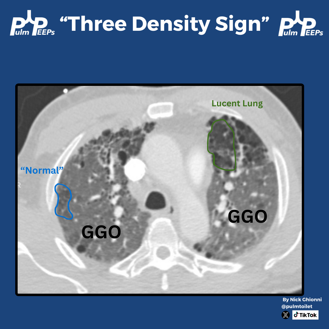 PulmPEEPs | Pulmonary and Critical Care content for learners and practitioners of all levels